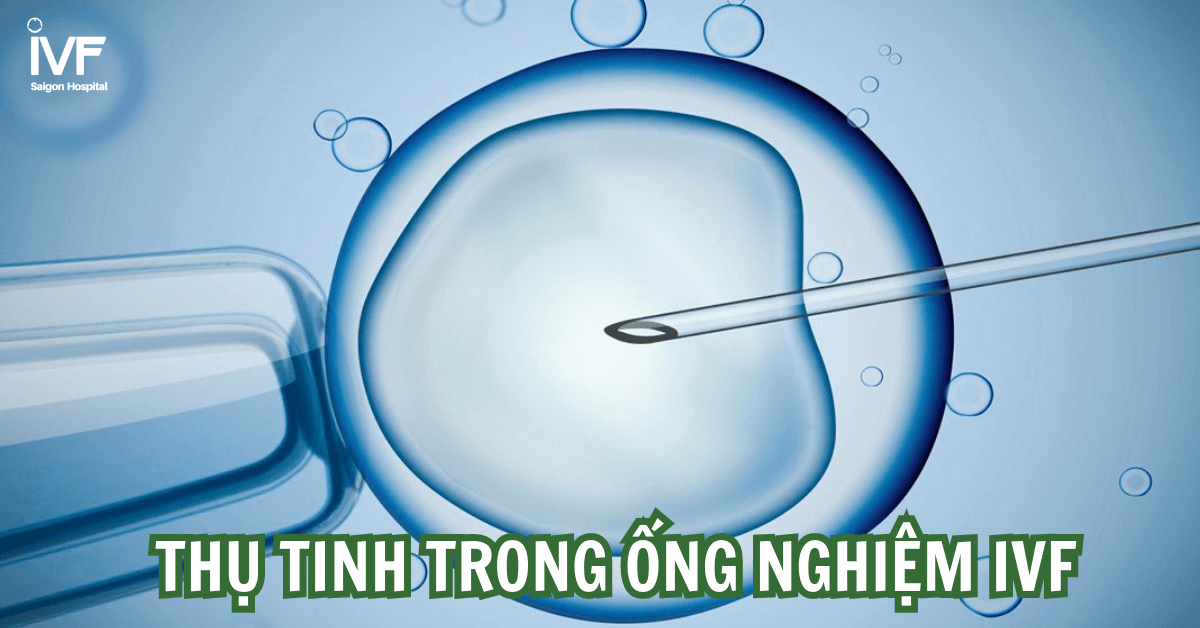 Bệnh viện sản hiếm muộn Sài Gòn IVF - Nơi mang đến hạnh phúc trọn vẹn ...