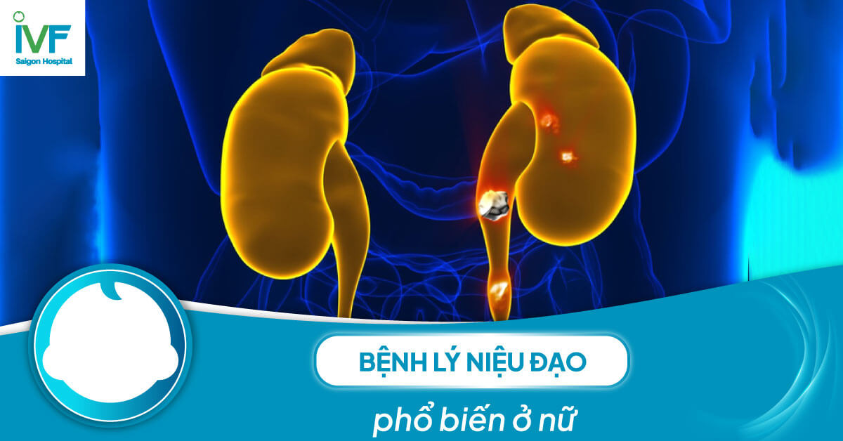 Bệnh lý niệu đạo phổ biến ở nữ: Nguyên nhân, triệu chứng và cách điều trị